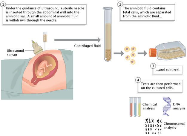 Prenatal Screen Detects Fetal Abnormalities | Learn Science at Scitable - beplay体育官方网站首页